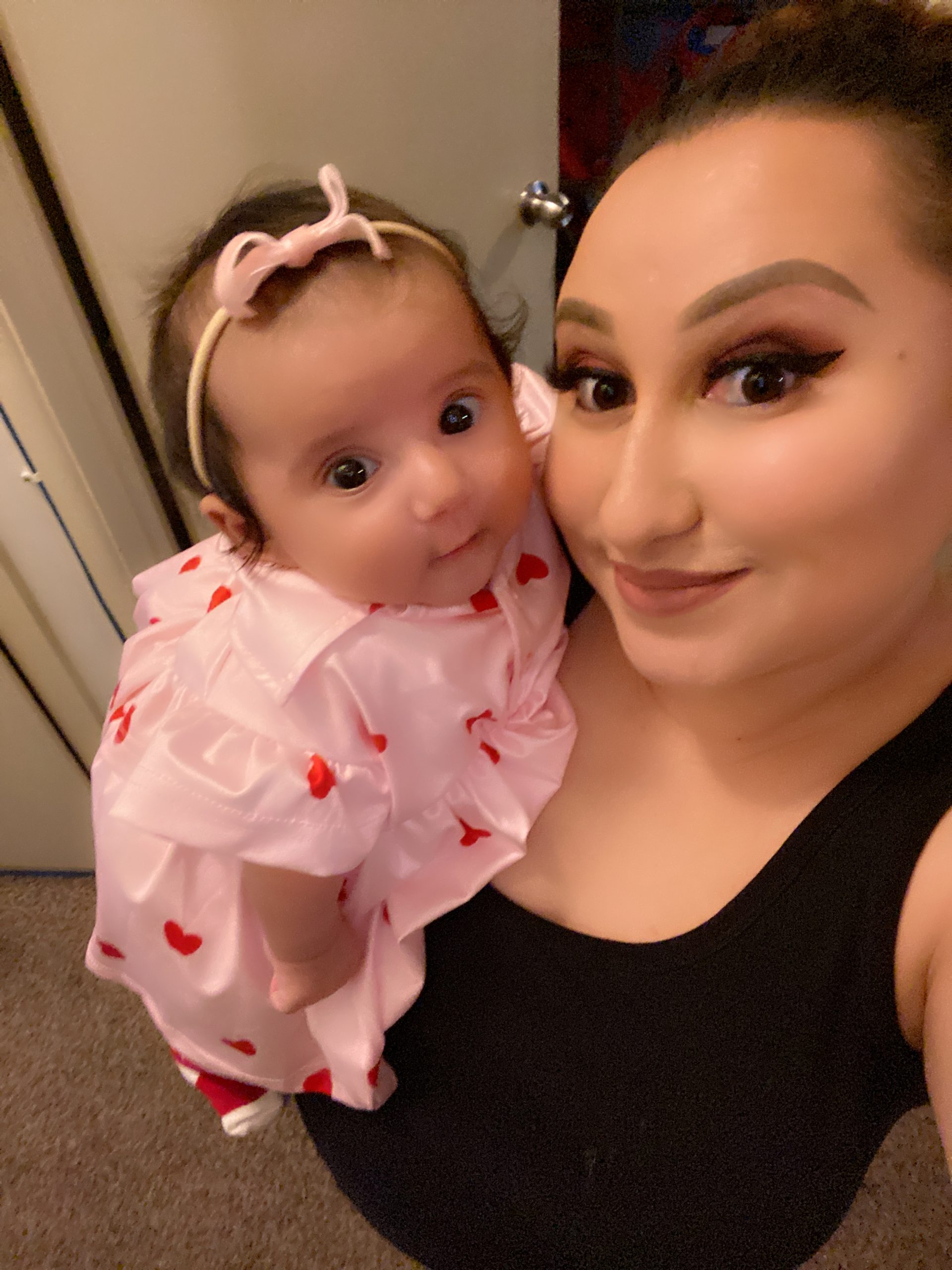 Osteogenesis Imperfecta Baby